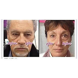 Instanly Ageless - Anti Wrinkle 5 Vials (.6mL Each)