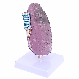 Anatomy Model Human Lung Model Human Pathological Lung Teaching Model, Internal Organs Champion Surgery, for Medical Demonstration Organs Model
