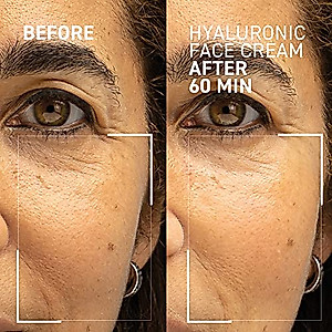 Needles No More Hyaluronic Face Cream - Long-Lasting Plumping Hydrator for Dehydrated and Dry Skin - 1.7 oz / 50 g