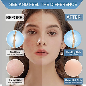 FEELSO Filtered Shower Head with Handheld, High Pressure 6 Spray Mode Showerhead with Filter, 15 Stages Water Softener Filters Beads for Hard Water-Remove Chlorine, Reduce Dry Itchy Skin, Extra Filter