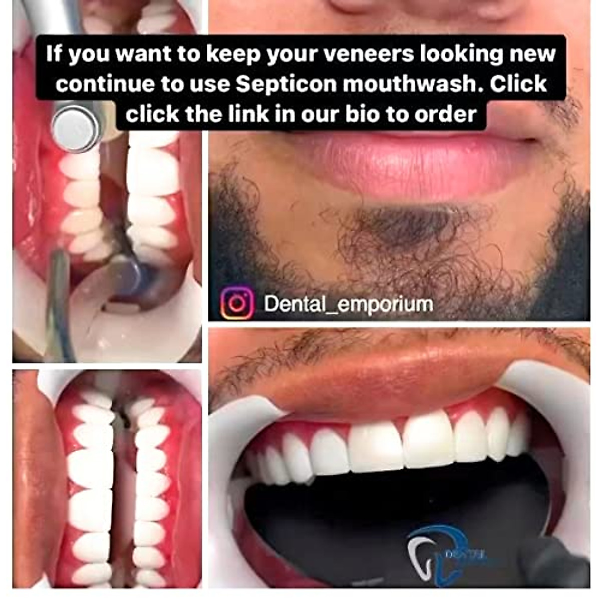 Septicon Mouthwash 16oz (Dominican Republic version)