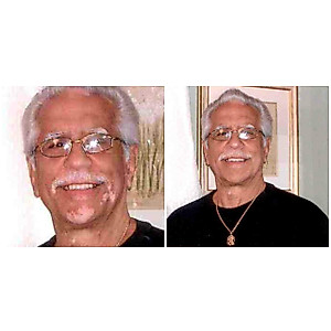 Judith August - Killer Cover Concealer - Classic - Cover Bruises, Tattoos, Age Spots, Vitiligo & More