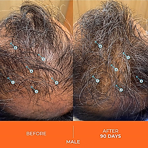 DS Laboratories Revita Hair Growth Conditioner for Fine & Thinning Hair, Biotin Treatment for Hair Regrowth, Thickening & Loss Prevention