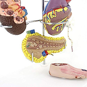 Teaching Model, Anatomy Model, Human Anatomy - Pathological Diabetes Model Diabetic Organ Anatomical Model, Complication Cerebral Pancreatic Neuron Surgery - Medical Educational Training Aid, 8 Parts