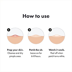 Mighty Patch Original from Hero Cosmetics - Hydrocolloid Acne Pimple Patch for Covering Zits and Blemishes, Spot Stickers for Face and Skin, Vegan-friendly and Not Tested on Animals (36 Count)
