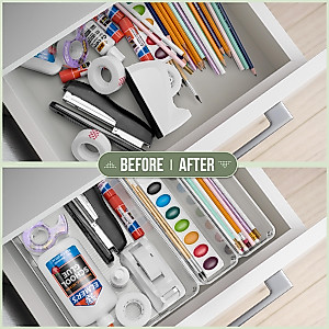 Sorbus Clear Plastic Storage Bins for Shelves, Clothes, with Handle - Clear Storage Bins, Drawer, Shelf, Closet, Pantry, Fridge, Freezer Organizer Bins, Closet Organizers and Storage (10 pack)