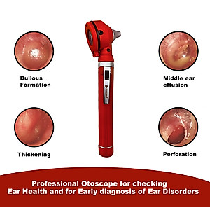 Cross Canada 11-082 Physician Fiber Optic LED Pocket Otoscope Diagnostic Set - Red