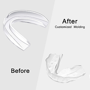 BBTO 20 Pieces Sports Mouth Guards Mouth Protection Athletic Mouth Guard or Boxing Basketball Football Hockey Karate Rugby Match(Transparent Color, Adult (11 Yrs & Above))