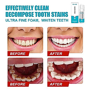 CCYP Brightify Deep Cleaning Foam Toothpaste,Deep Cleansing Foam Toothpaste Eelhoe, Teeth Whitening Toothpaste, Baking Soda Toothpaste, Intensive Stain Removal Toothpaste (1pcs)