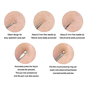 Blackhead Remover Pimple Comedone Extractor Tool Acne Kit - Treatment for Blemish, Whitehead Popping, Zit Removing for Risk Free Nose Face Skin (Sliver)