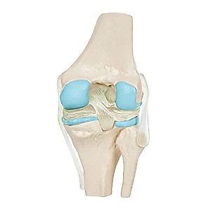 Spancare 4 Stage Osteoarthritis Anatomical Knee Model, Model On Base, with Detailed Study