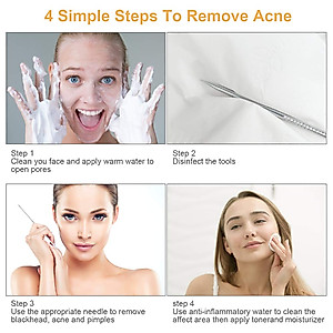 Pimple Popper Tool Kit, UUBAAR 9 PCS Blackhead Remover Tools with Tweezers, 16-Heads Professional Acne Zit Pimple Popper Extraction Tools, Whitehead Comedone Extractor Kit for Facial Nose