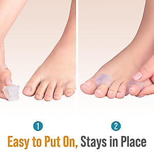 5 STARS UNITED Toe Spacers for Men and Women – 4 Gel Toe Separators for Curled and Overlapping Toes, Bunions, Hammer Toe Straightener, Big and Second Toe Spreader - White
