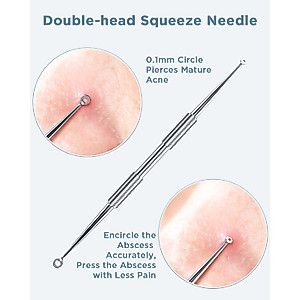 TAYTHI Blackhead Remover Tool, Pimple Popper Tool Kit, Blackhead Extractor Tool for Face, Extractor Tool for Comedone Zit Acne Whitehead Blemish, Stainless Steel Extraction Tools