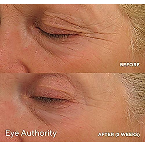 HydroPeptide, Wrinkle Rescue Starter Kit, Anti-Aging Essentials Kit, 1 Count