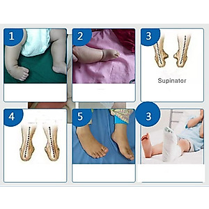 Kids AFO Drop Foot Splint, Toddler Strephenopodia Splint for Foot Drop, Plantar Fasciitis & Achilles Tendonitis, Ankle Foot Brace Night Splint for Right or Left Foot. (Large)