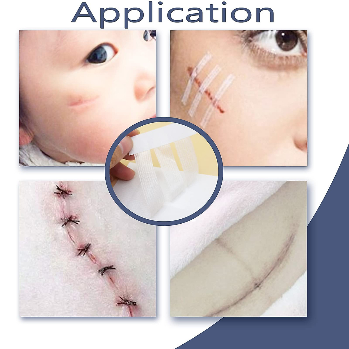 Mediss Disposable Skin Wound Closures Band Aid Adhesive Bandages, Sterile Stitch Strips After Injury, Survival, Healing, 10 Pcs