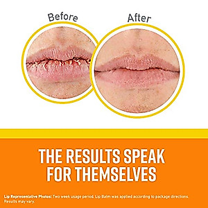 O'Keeffe's Lip Repair SPF 35 Lip Balm Stick, (Pack of 3)