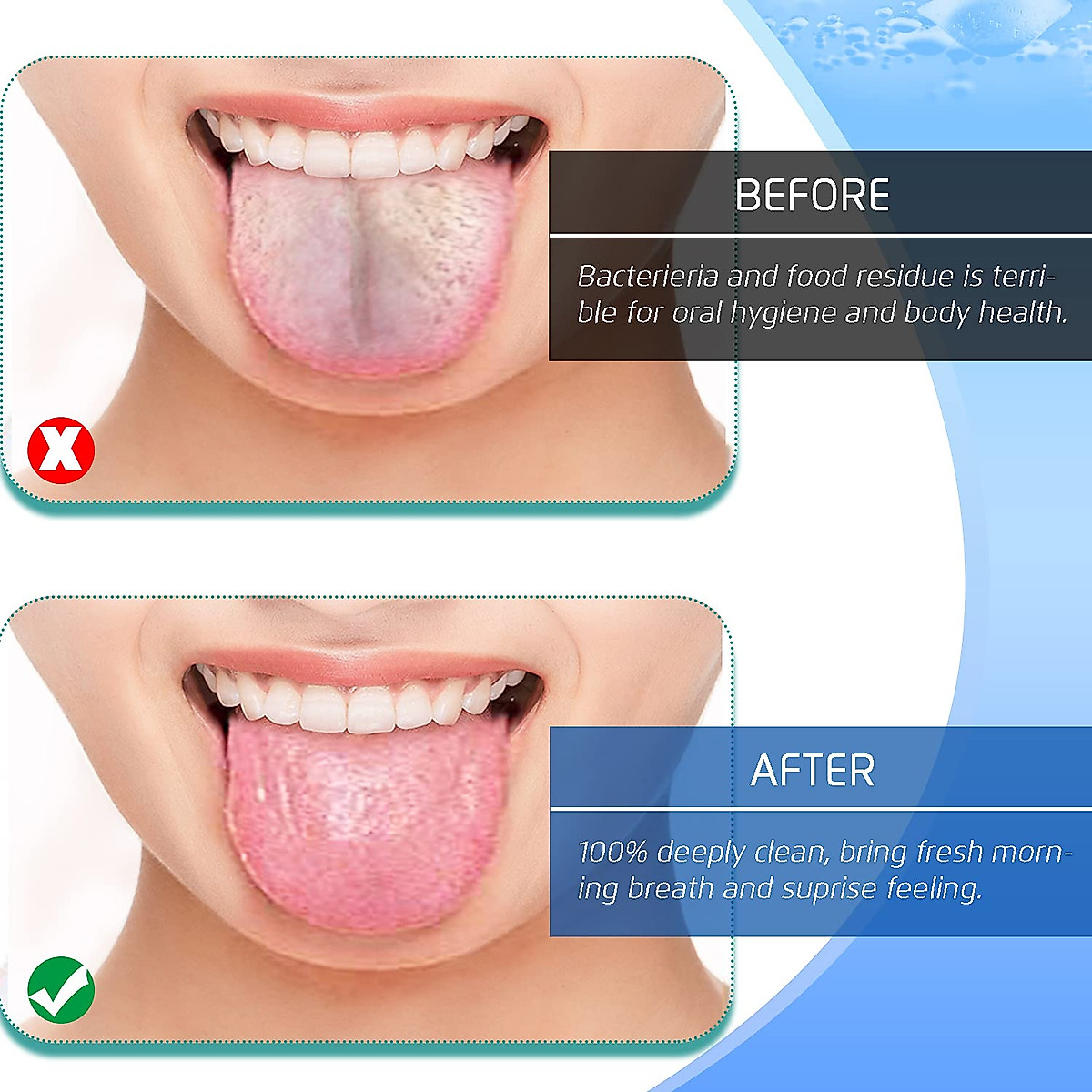 4PCS Tongue Scraper, Stainless Steel Tongue Cleaners, 100% BPA Free Fresher Tongue Tools, Healthy Oral Hygiene Brushes, Medical Grade Reusable Stainless Steel, Eliminate Bad Breath