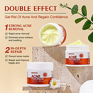 Acne Treatment for Face, Acne Cream Back Acne Treatment Cream for Teens & Adults Anti-acne Pimple Cream Butt Acne Clearing Cream, Acne Spot Treatment