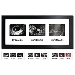 IHEIPYE Triple Sonogram Pregnancy Frame – Baby Ultrasound Picture Frame with Story for Expecting Parents, Baby Shower Frame, Baby Grow Through All Three Trimesters Frame, Nursery Decor, Black