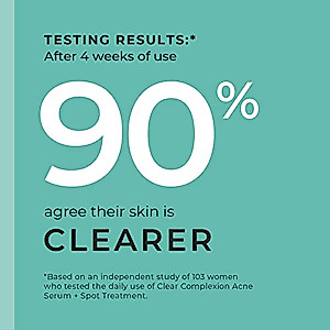 Urban Skin Rx Clear Complexion Acne Serum + Spot Treatment | Helps to Reduce + Prevent Breakouts, Improves the Look of Blemishes and Aging Skin with 5% Benzoyl Peroxide and 5% Glycolic Acid | 1 Fl Oz