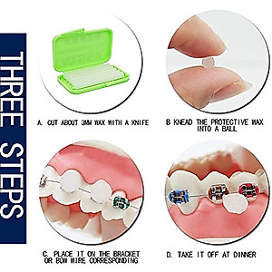 RZJZGZ Dental Oral Care Orthodontics Wax with Fruit Smell for Brace Wearers Flavored Gum Protection (3Pack)