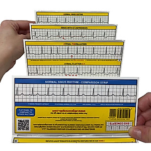 R-CAT for Arrhythmias EKG Pocket Reference Guide – Great Study Card for EKG Interpretation - ACLS and PALS Training – Cardiac Rhythm Interpretation Made Easy