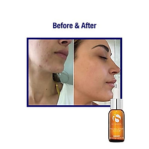 Pro-Heal Serum Advance+ Antioxidant-rich Vitamin C Serum, Vitamin E And Retinol For Redness, Rosacea And Inflammation