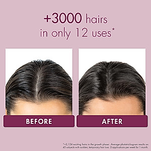 Klorane Strengthening Serum with Quinine and Edelweiss for Thinning Hair, Supports Thicker, Stronger, Healthier Hair, For Men and Women, Paraben, Silicone and Sulfate Free, 3.3 Fl Oz