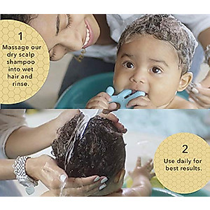 BELLA B Bee Gone Cradle Cap Baby Shampoo 8 oz - Natural Shampoo - Dry Scalp Shampoo - Cradle Cap Shampoo For Babies - Cradle Cap Treatment For Babies - Organic Baby Shampoo- Natural Baby Shampoo