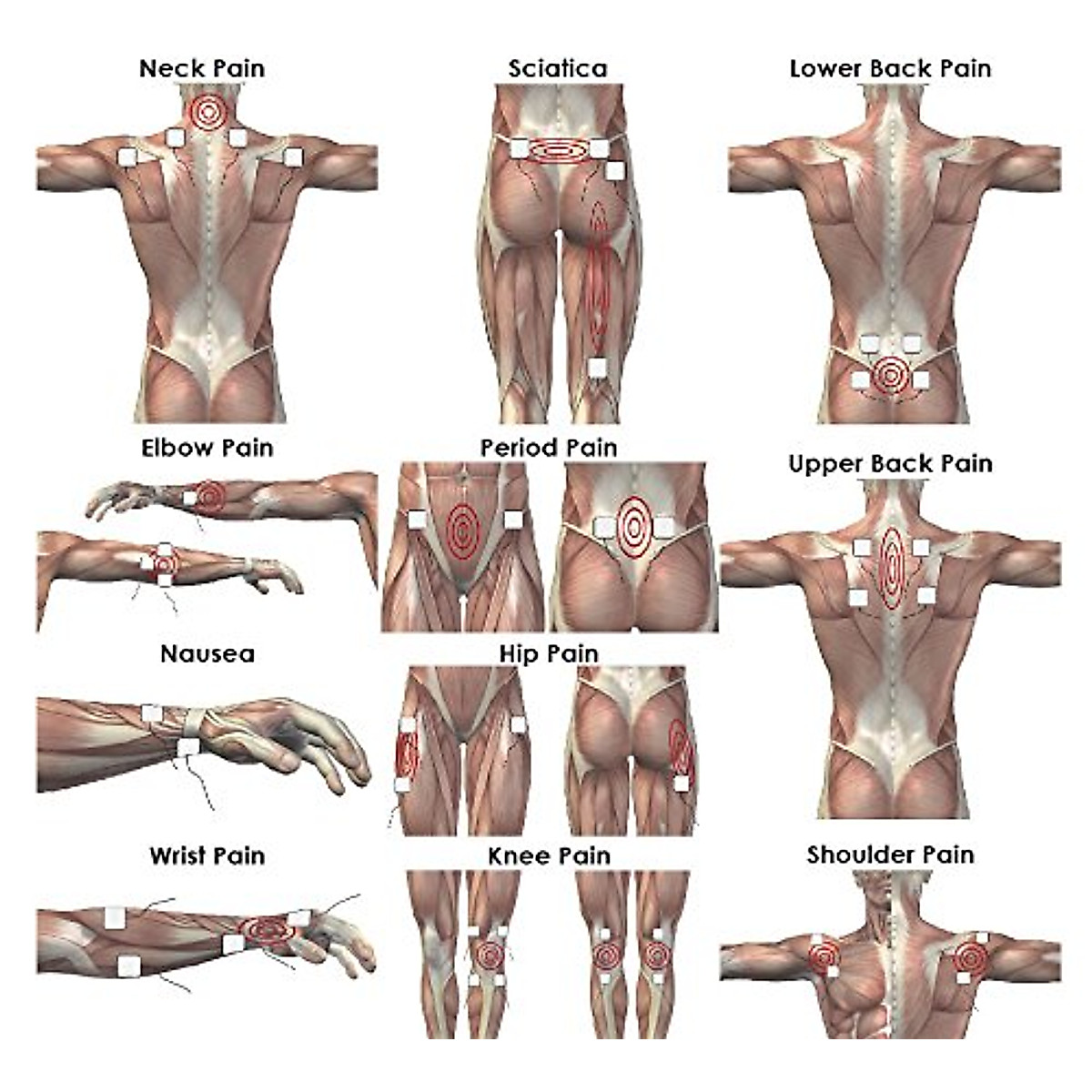 TensCare - 1in Cicrular Reusable Electrodes. Perfect for use with TENS, EMS, Micro Current and IFT. Great for Small Locations Such as Hands and Face. 1 Pack of 10 Electrodes