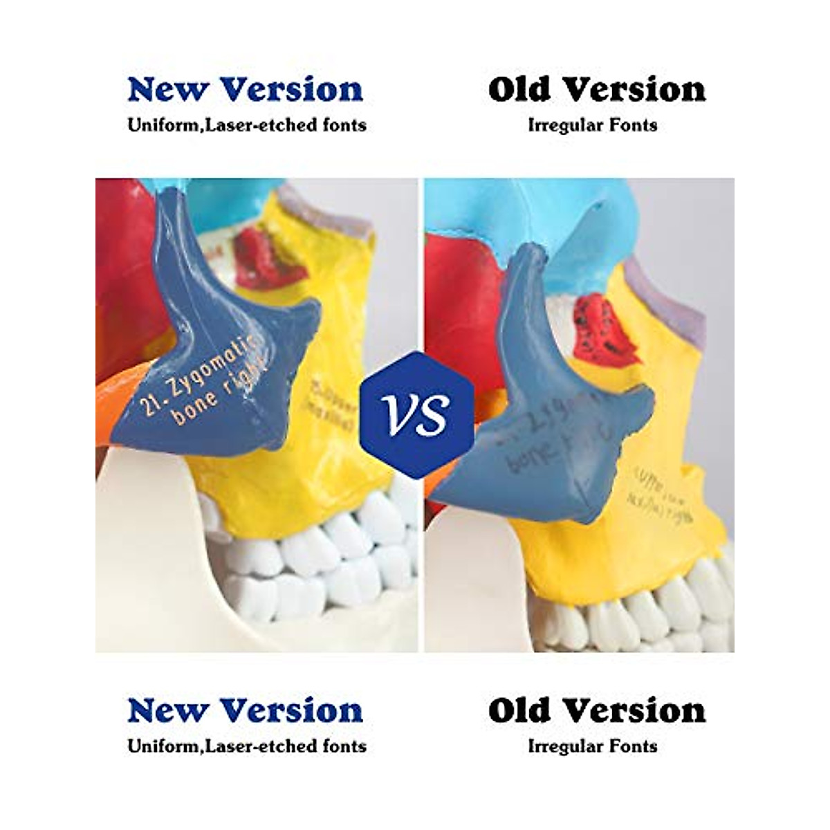 Upgraded Life Size Human Colored Head Skull Anatomical Model with Newest Laser-Etched Fonts and Skull Diagram Mouse Pad for Medical Student Human Anatomy Study Course Demonstration, Teaching