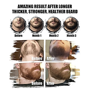 Beard Kit for Men Grooming & Care with 2 Pack Beard Oils, Balm, Wash & Conditioner for After Shave Lotions-Sandalwood, Brush, Combs, Scissors, Valentine's Day Christmas Fathers Gifts for Dad Men Him