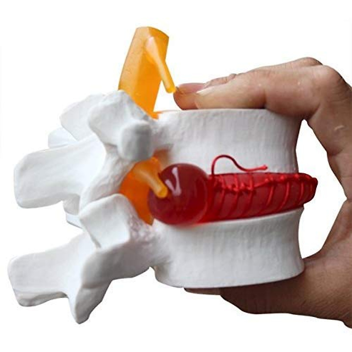 Doc.Royal Anatomical Human Lumbar Vertebrae Degenerative Lumbar Human Spine Model 1PCS