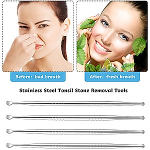 Nuanchu 4 Pieces Stainless Steel Tonsil Stone Removal Pick Tonsillolith Tool Oral Cleaner to Get Rid of Bad Breath