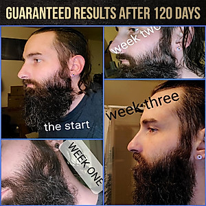 The Beard Struggle Voxtr Beard Growth Serum with Follicle Acceleration Matrix - Promotes Thicker & Healthier Beard - Beard Serum, 1.69 Fl. Oz. US