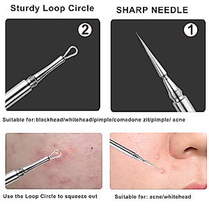 Professional Facial Milia Removal and Whitehead Extractor & Lancet - Double Ended Circle Loop & Sharp Needle Pimple Popper Tool - 2-in-1 Blackhead & Blemish Remover - Zit and Pimple Acne Removal