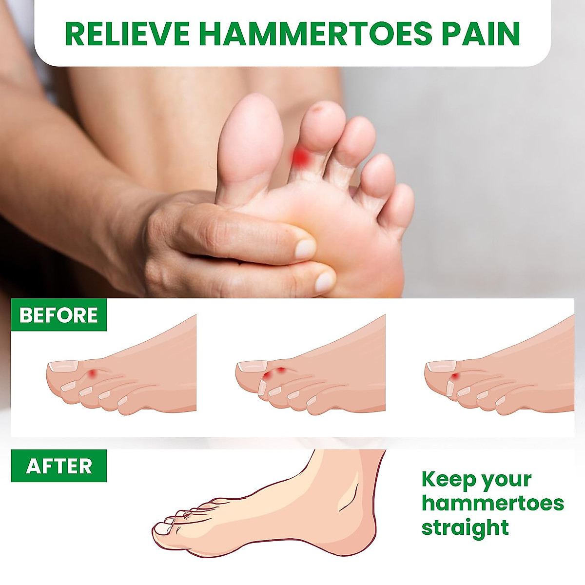 Bukihome Hammer Toe Straightener - 6 Pack Toe Splints - Soft Gel Hammer Toe Cushion - Realign Bent, Curled, Crooked, Claw, Hammer Toes - Toe Corrector for Men and Women, Medium Size