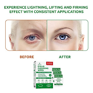 SaluVera Eyelid Wipes with Tea Tree and Aloe Vera | Eye Lid Cleaning Wipes for Dry and Itchy Eyes Relief | Natural Ingredients Eyelid Scrub for Daily Usage - Pack of 30