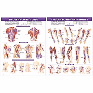 Trigger Point Chart Set: Torso & Extremities Lam