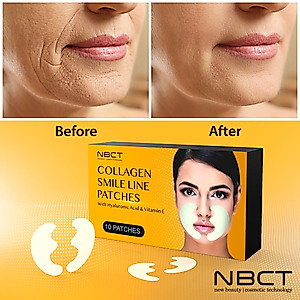 NBCT Collagen Smile Line Wrinkle Patches with Hyaluronic Acid, Aloe Vera, Vitamin E, Skin Safe & Botox Alternative