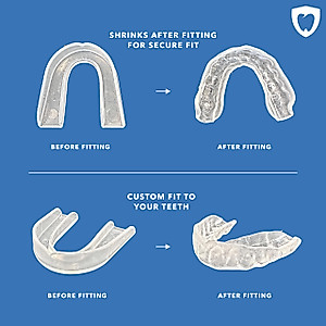 Zero-Grind Nightguard - Custom Fit Night Guard for Teeth Grinding
