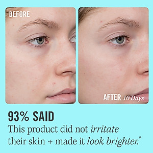 First Aid Beauty 10% Vitamin C Brightening Serum, Safe for Sensitive Skin, Helps Brighten + Visibly Firm Face + Neck, 1.7 oz