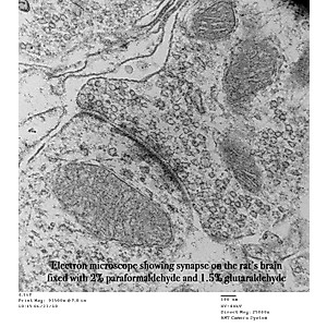 Paraformaldehyde, 4% in PBS - 500 mL - PFA04-500R
