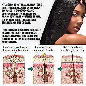 for Men Sensitive Skin Extra Strength Hair Nourishing Hair Oil Control Frizz Strengthen Hair Loss Of Solid Hair Fluffy Dense Hair Nourishing Hair Care 30ml 1fl.oz Mens Beard Care