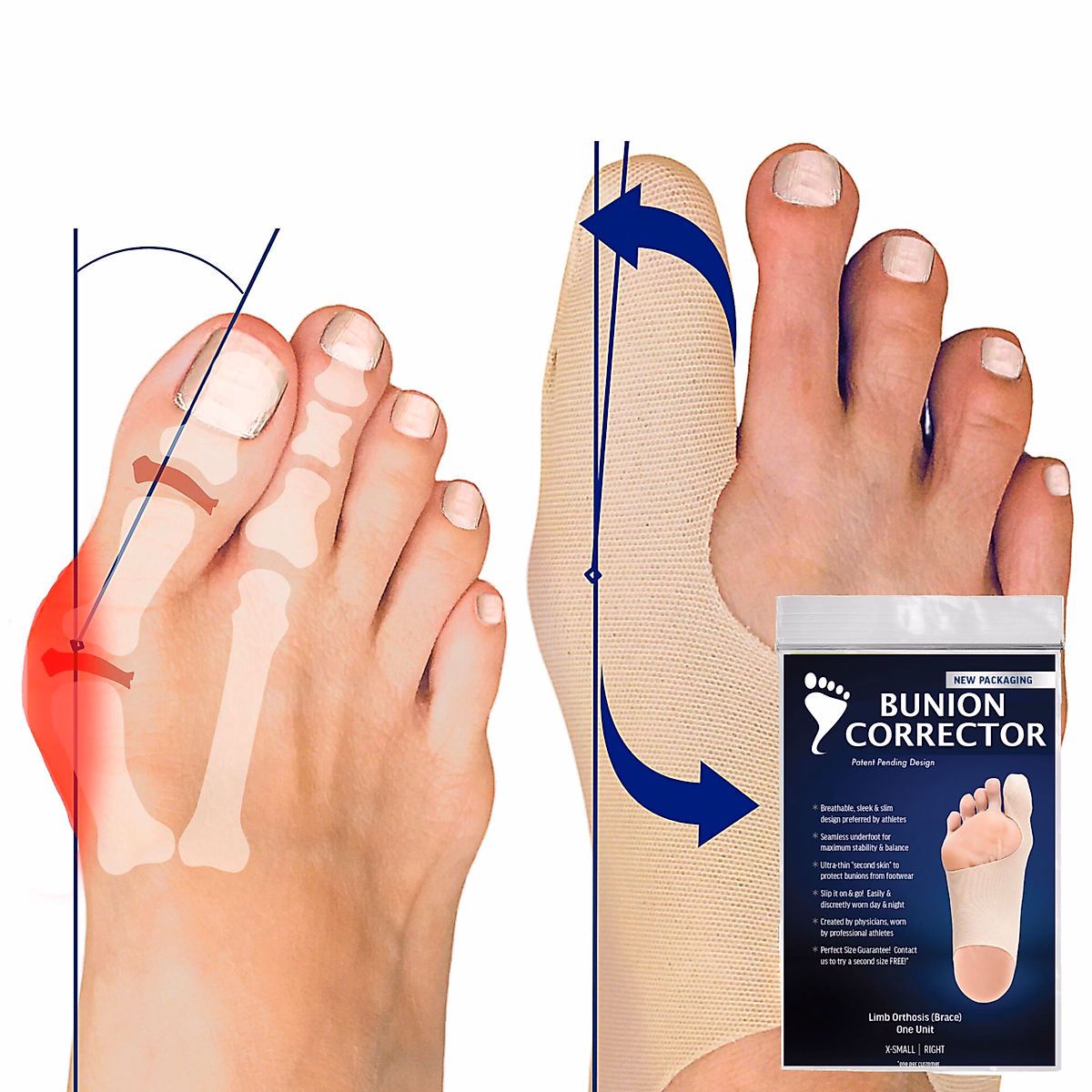 Bunion Corrector for Men & Women Big Toe Straightener for Inside Shoes Socks. Ultra Thin Hallux Valgus Socks to Separate & Straighten Great Toes. Day & Night Splints for Juanetes, X-Large-Left