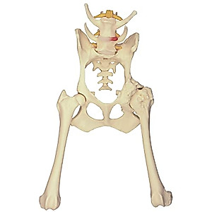 GPI Anatomicals - Canine Pelvis Model, Normal and Osteoarthritic Hip Joint Bones for Anatomy and Physiology Education, Anatomy Model for Veterinarian’s Offices and Classrooms, Medical Study Supplies