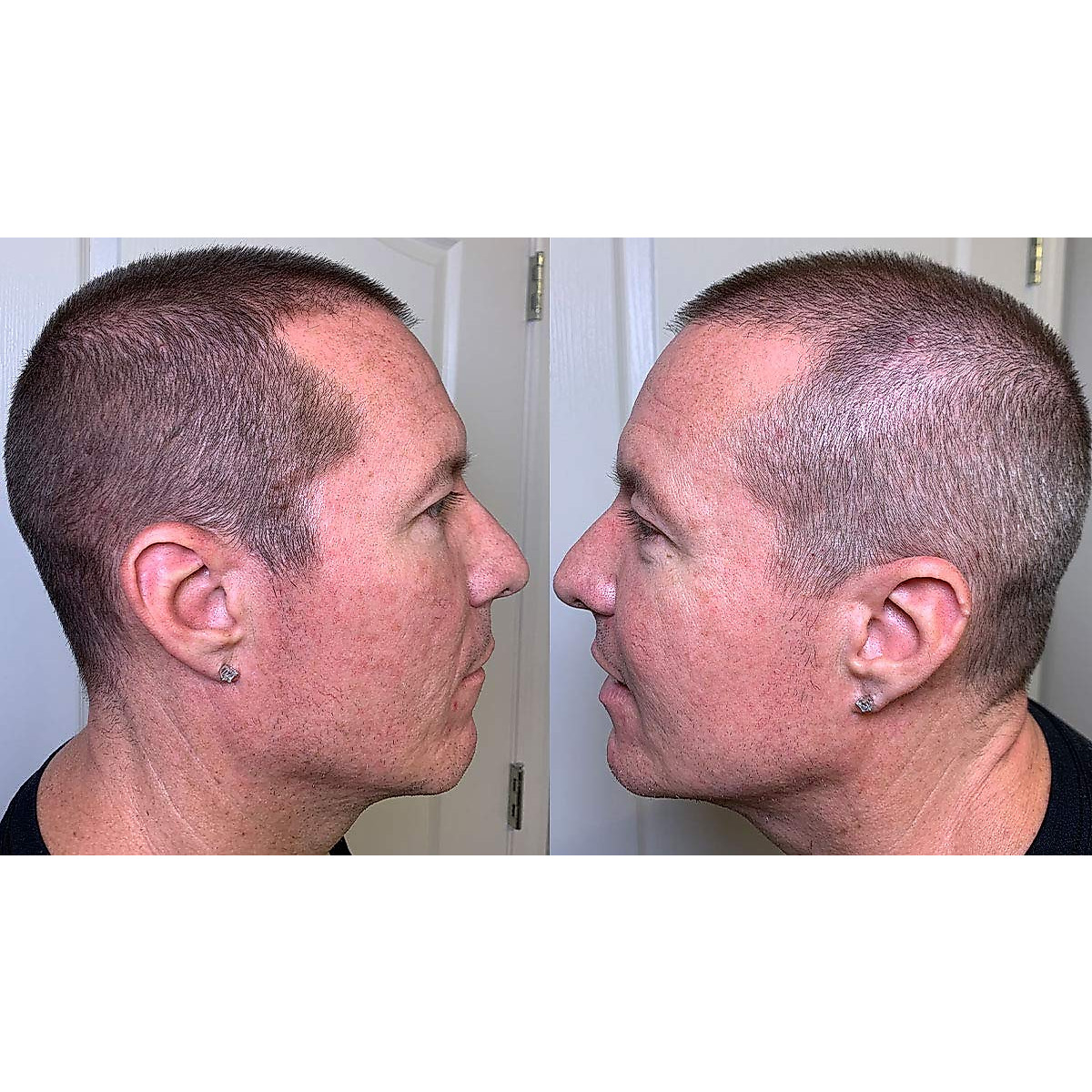 Thicken It 100% Scalp Coverage Hair Powder - BLACK - Talc-Free, Water Resistant Hair Loss Concealer, Thicker Than Hair Fibers & Sprays