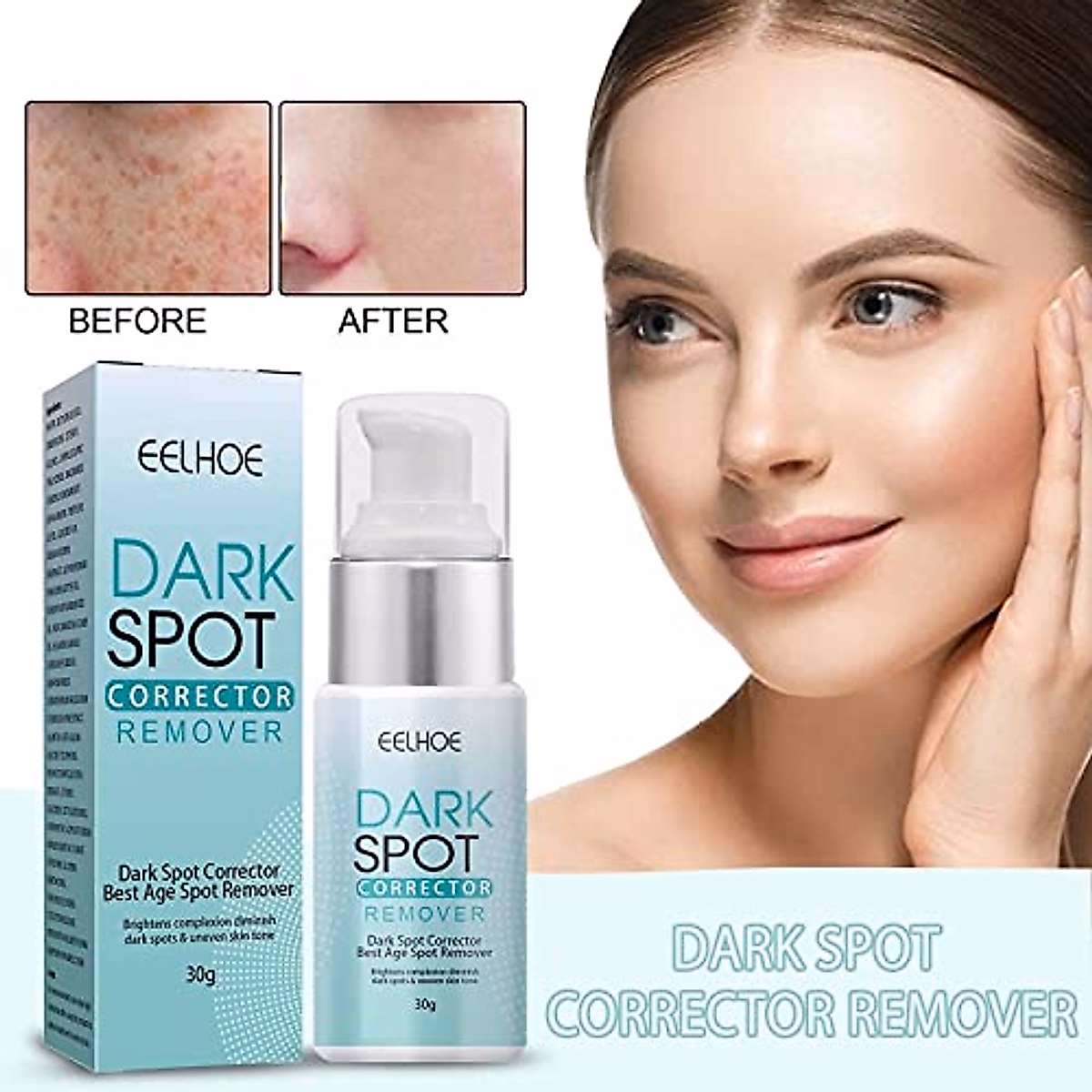 3Pack Musely Dark Spot Cream,Dark Spot remover for Face,The Spot Cream for Face,Dark Spot Correct Cream, Freckle Remover and Discoloration Correcting Serum